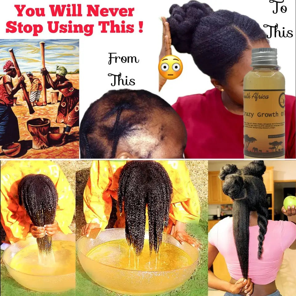 7 Days Extreme Hair Growth Oil 😳 – Just Your Hair